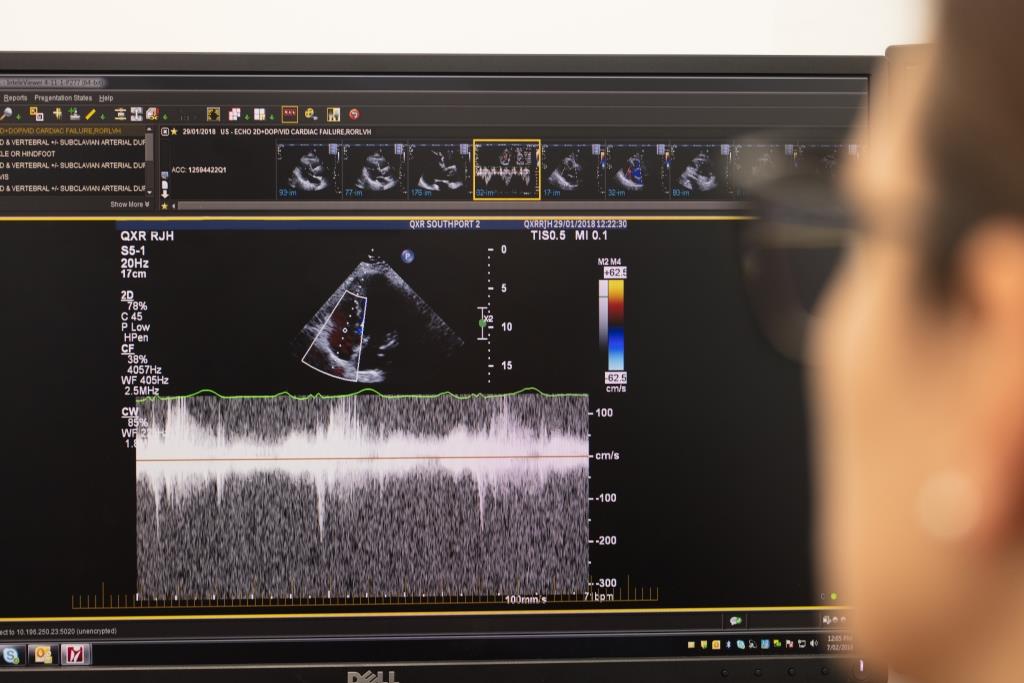 Echocardiography | Ultrasound | Queensland X-Ray