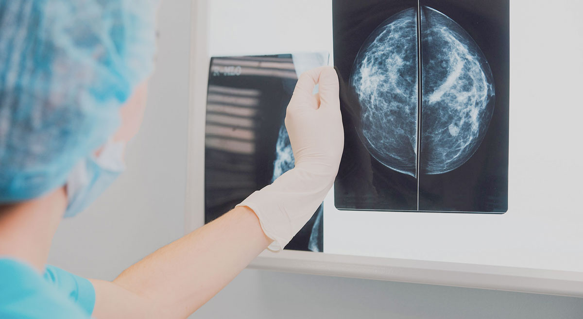 Screening & Diagnostic Mammography | Queensland X-Ray