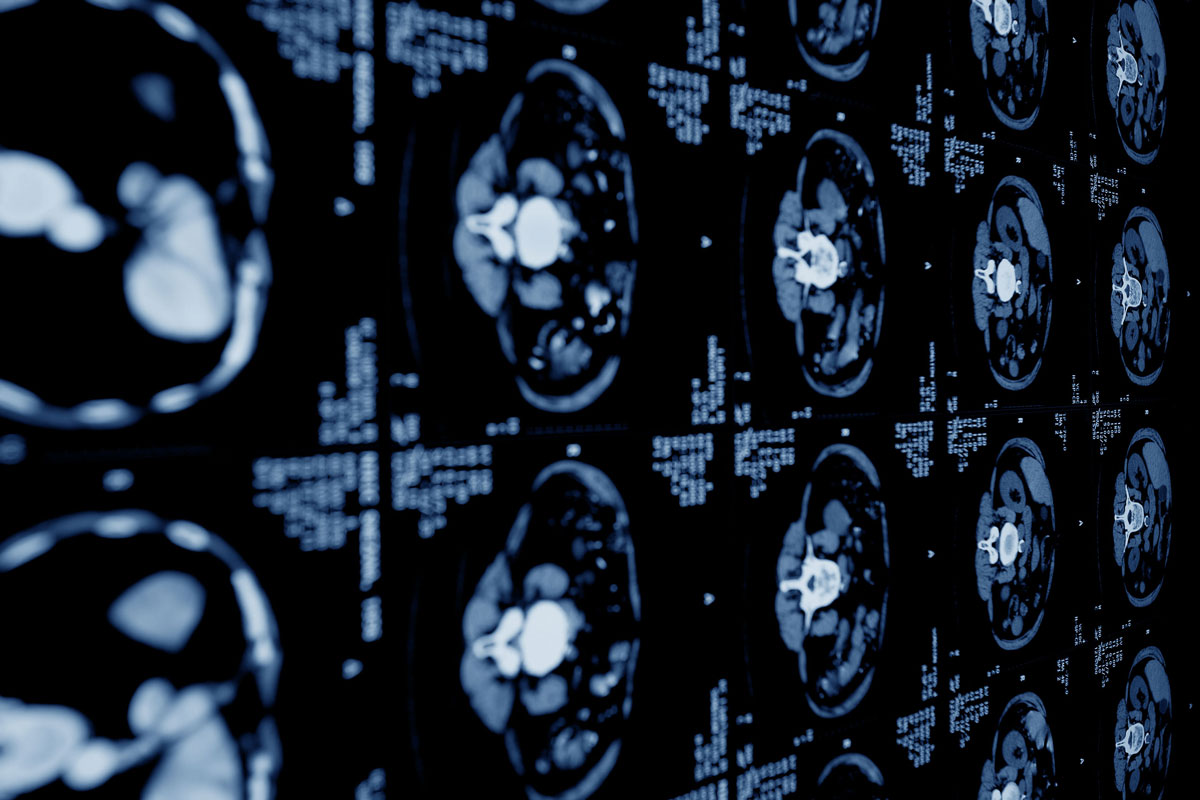 Pelvic MRI | Queensland X-Ray